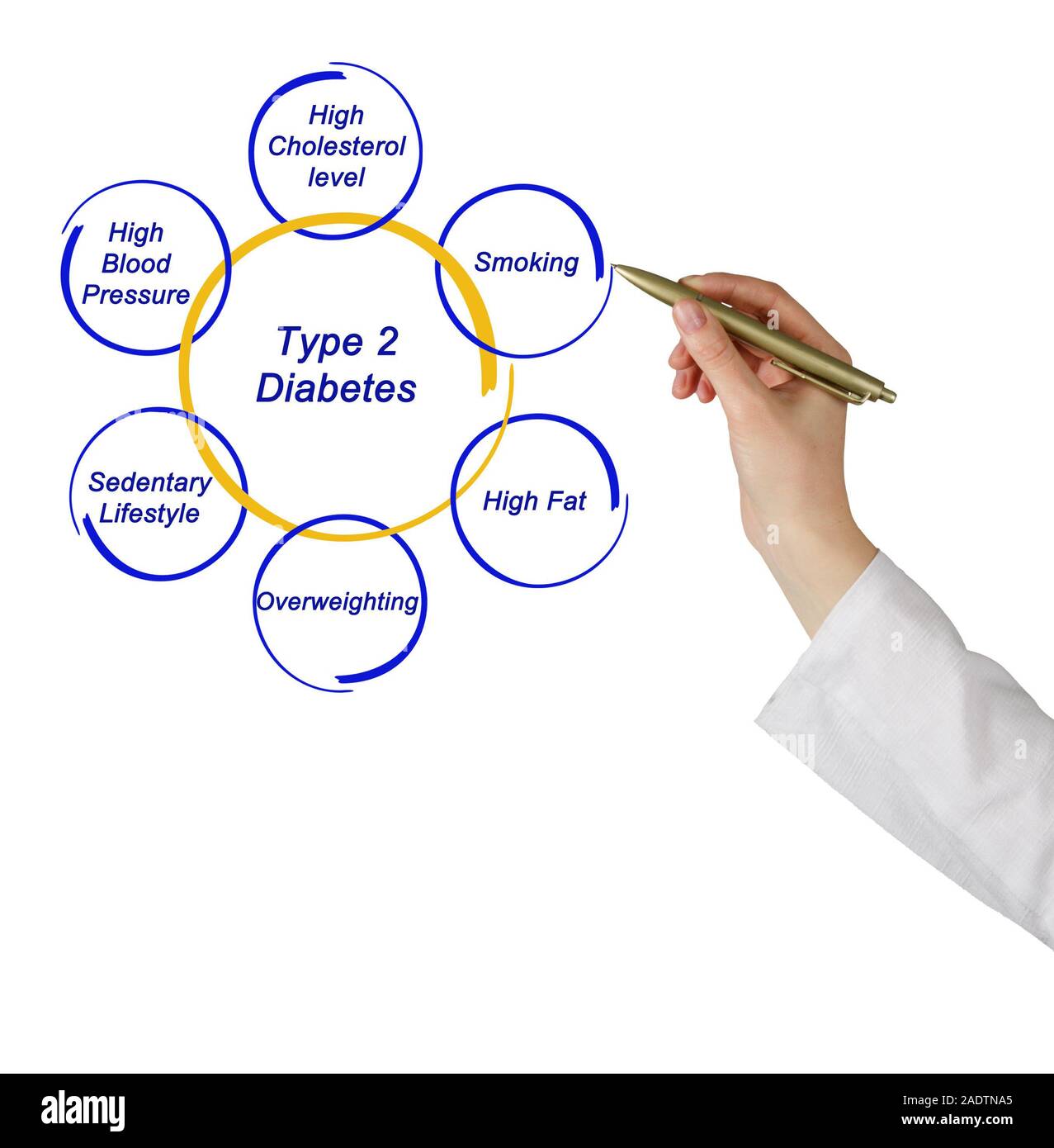 Type 2 diabetes diagram hi-res stock photography and images - Alamy