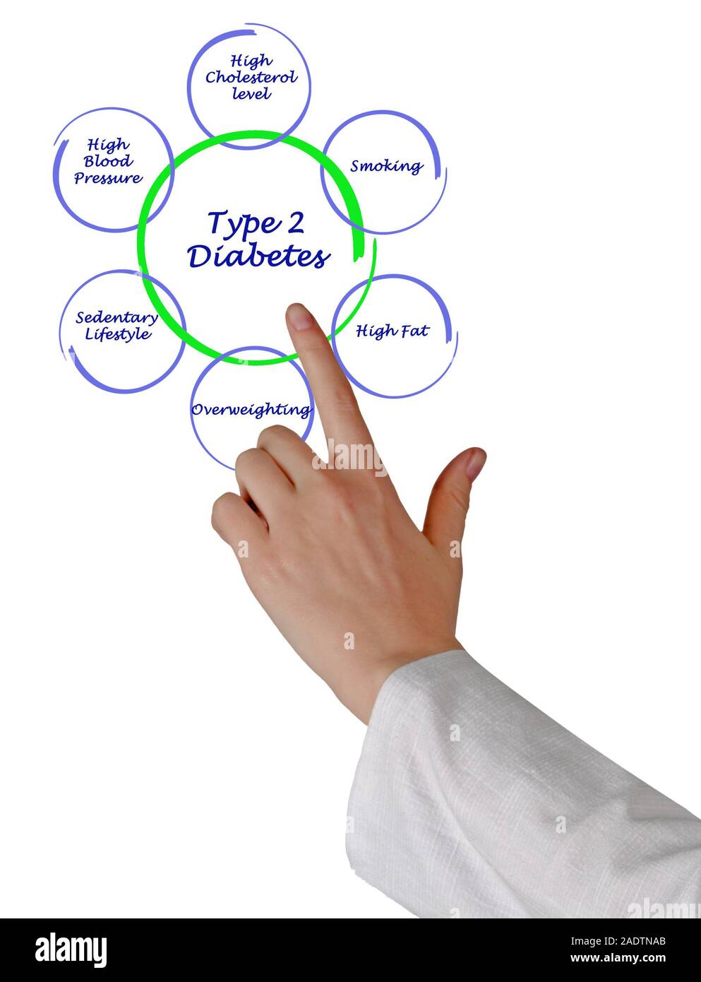 Type 2 diabetes diagram hi-res stock photography and images - Alamy