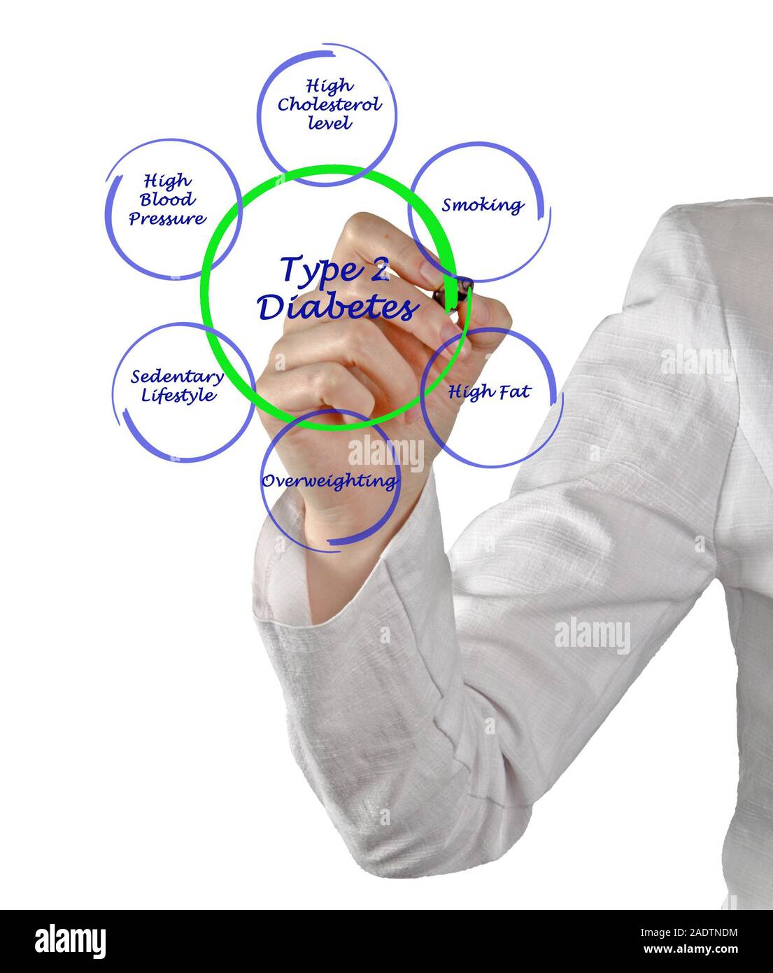 Type 2 diabetes diagram hi-res stock photography and images - Alamy