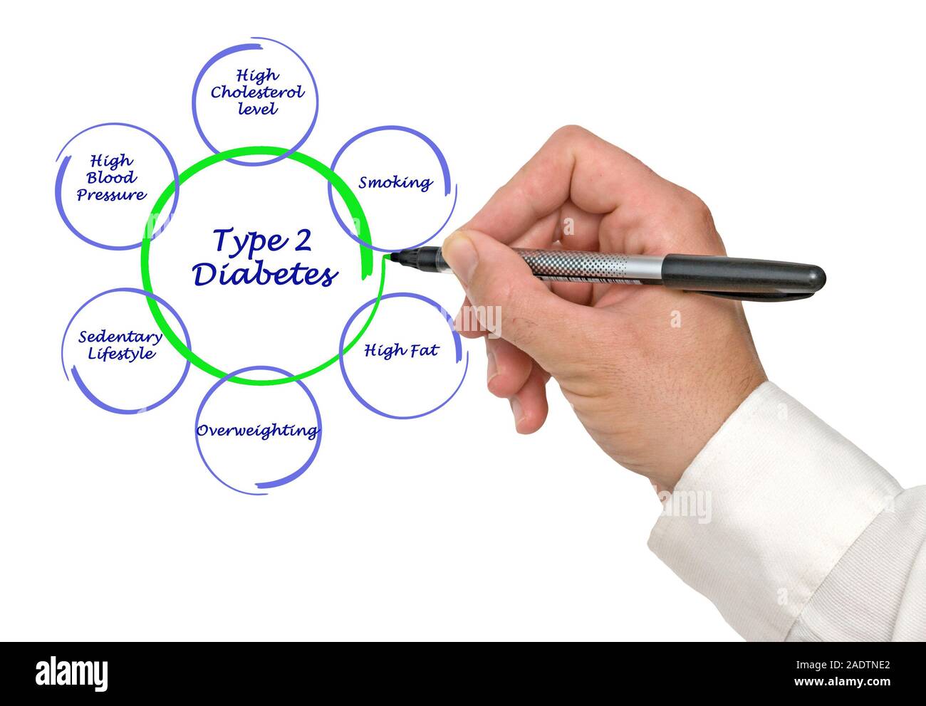 Type 2 diabetes diagram hi-res stock photography and images - Alamy