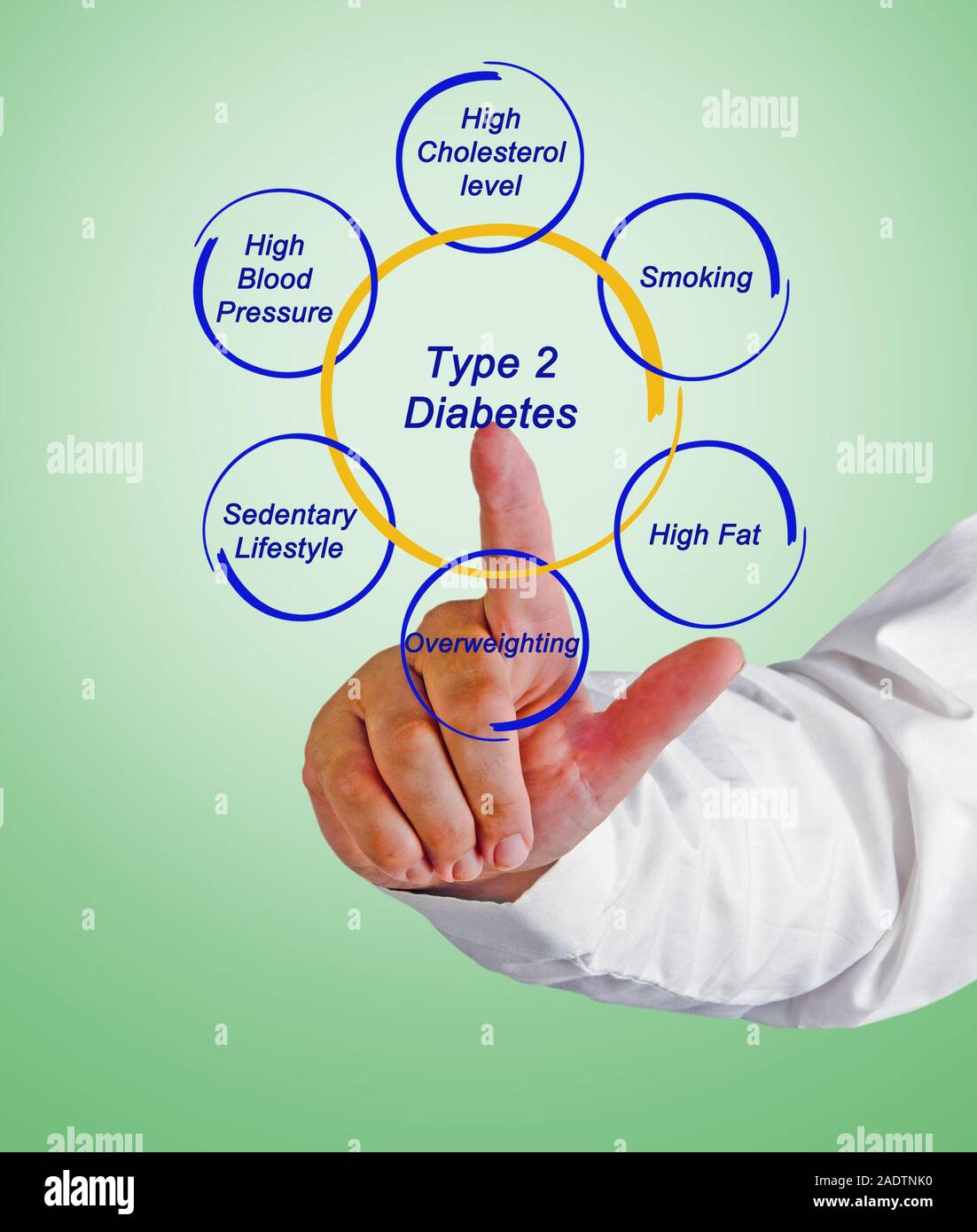 Type 2 diabetes diagram hi-res stock photography and images - Alamy