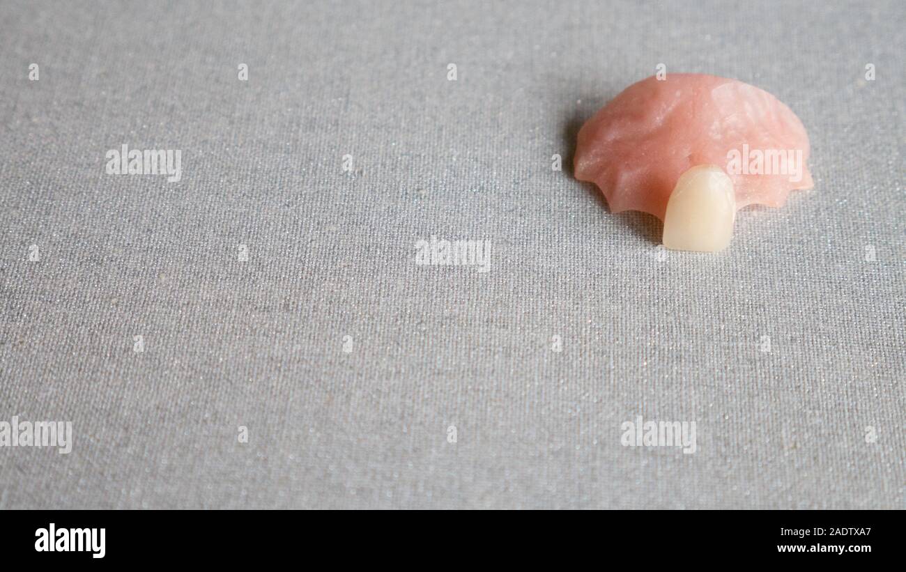 One false plastic tooth. Dentistry. Prosthetic teeth. Dental plates ...