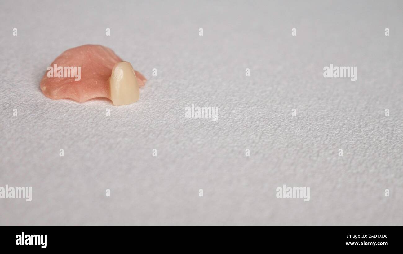 One false plastic tooth. Dental prosthetics on a background. Dentures ...