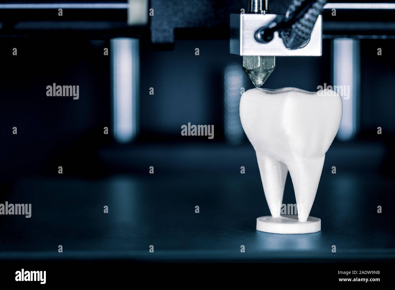 Using a 3D printer in dentistry, dentures are made by fused filament ...