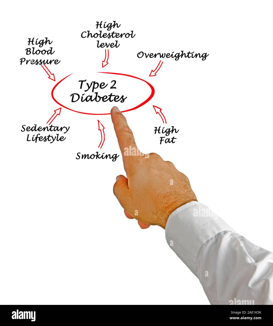 Type 2 diabetes diagram hi-res stock photography and images - Alamy