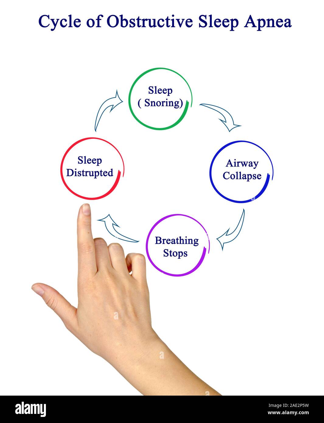 Cycle of Obstructive Sleep Apnea Stock Photo - Alamy