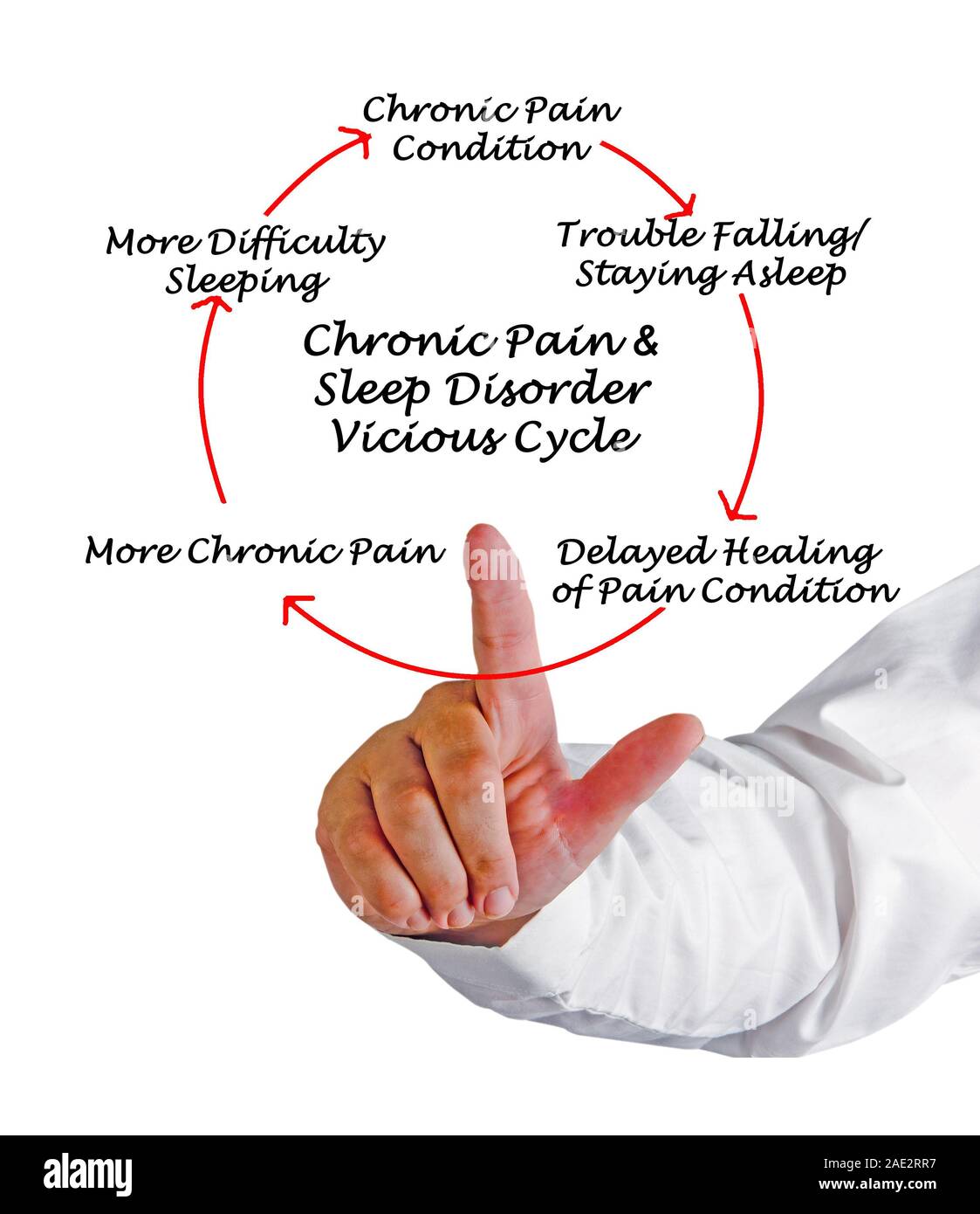 Chronic Pain & Sleep Disorder Vicious Cycle Stock Photo - Alamy