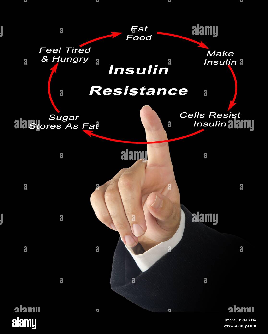 Development of Insulin Resistance Stock Photo - Alamy