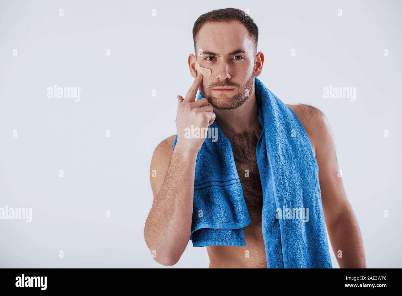 Scratch on face. Man with blue towel stands against white background in ...