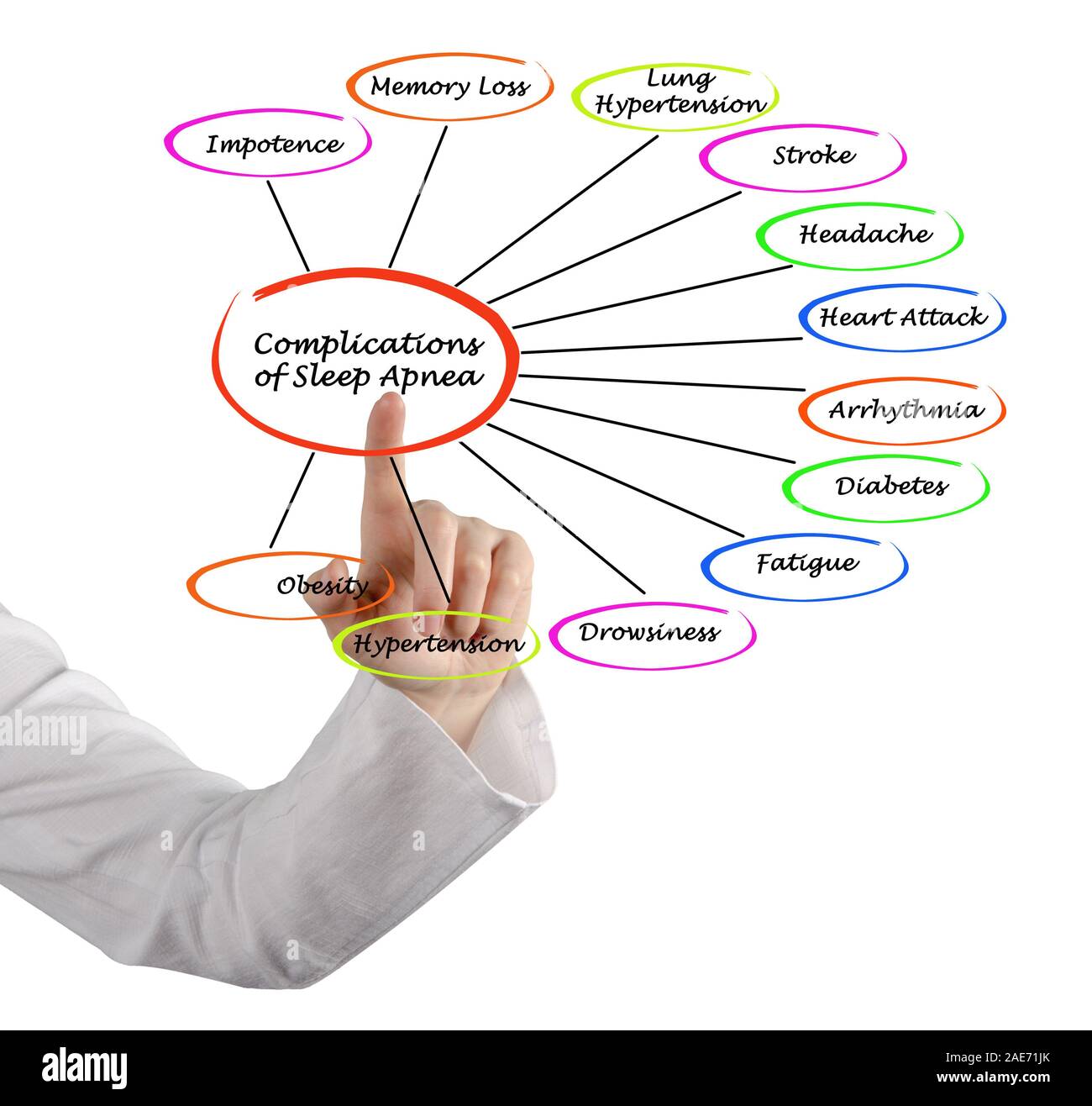 Hypertension complications hi-res stock photography and images - Alamy