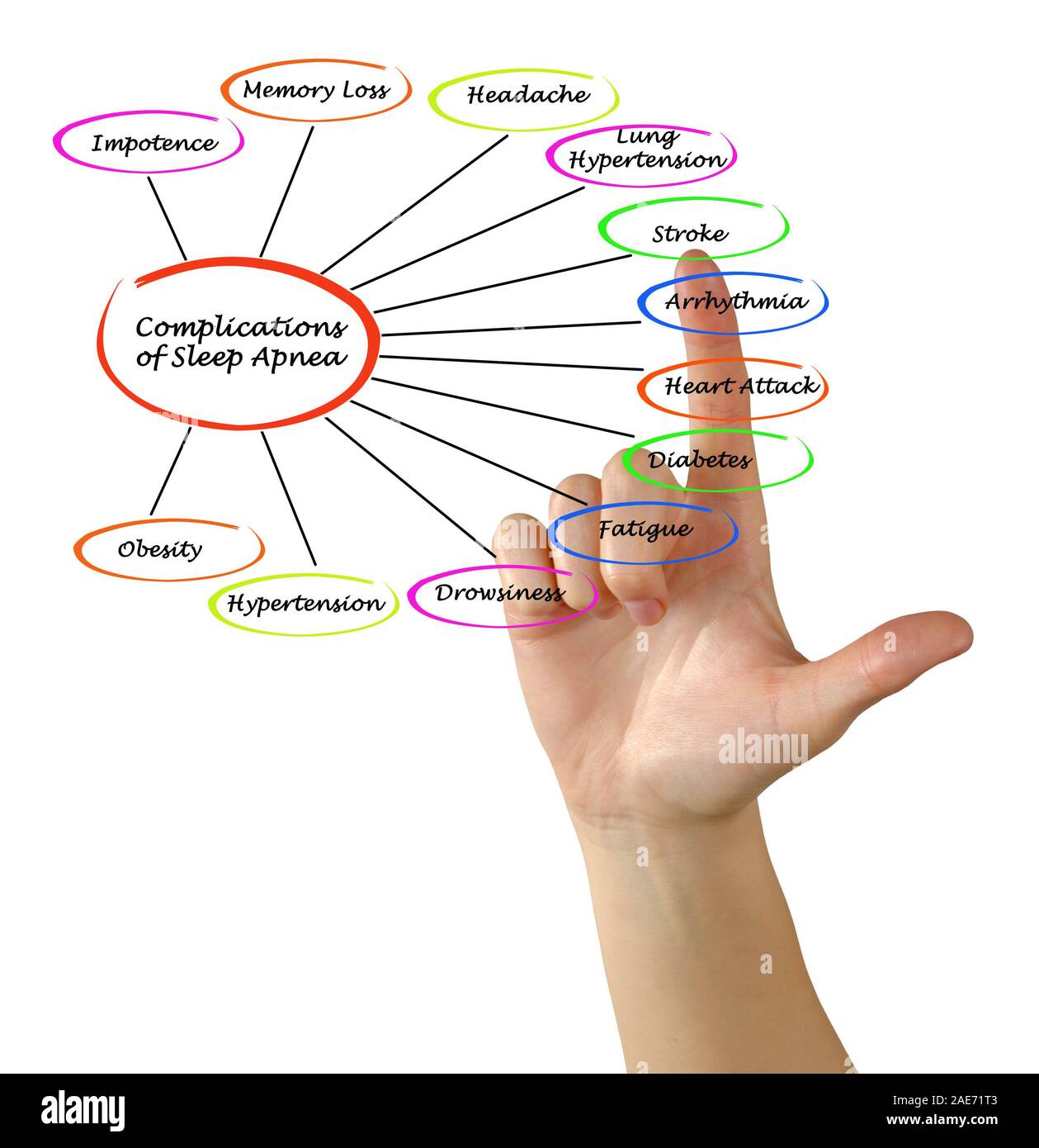 Hypertension complications hi-res stock photography and images - Alamy
