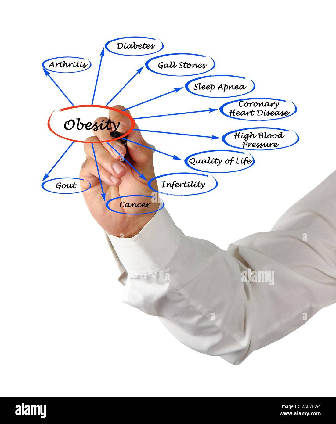 Diagram of Obesity Stock Photo - Alamy