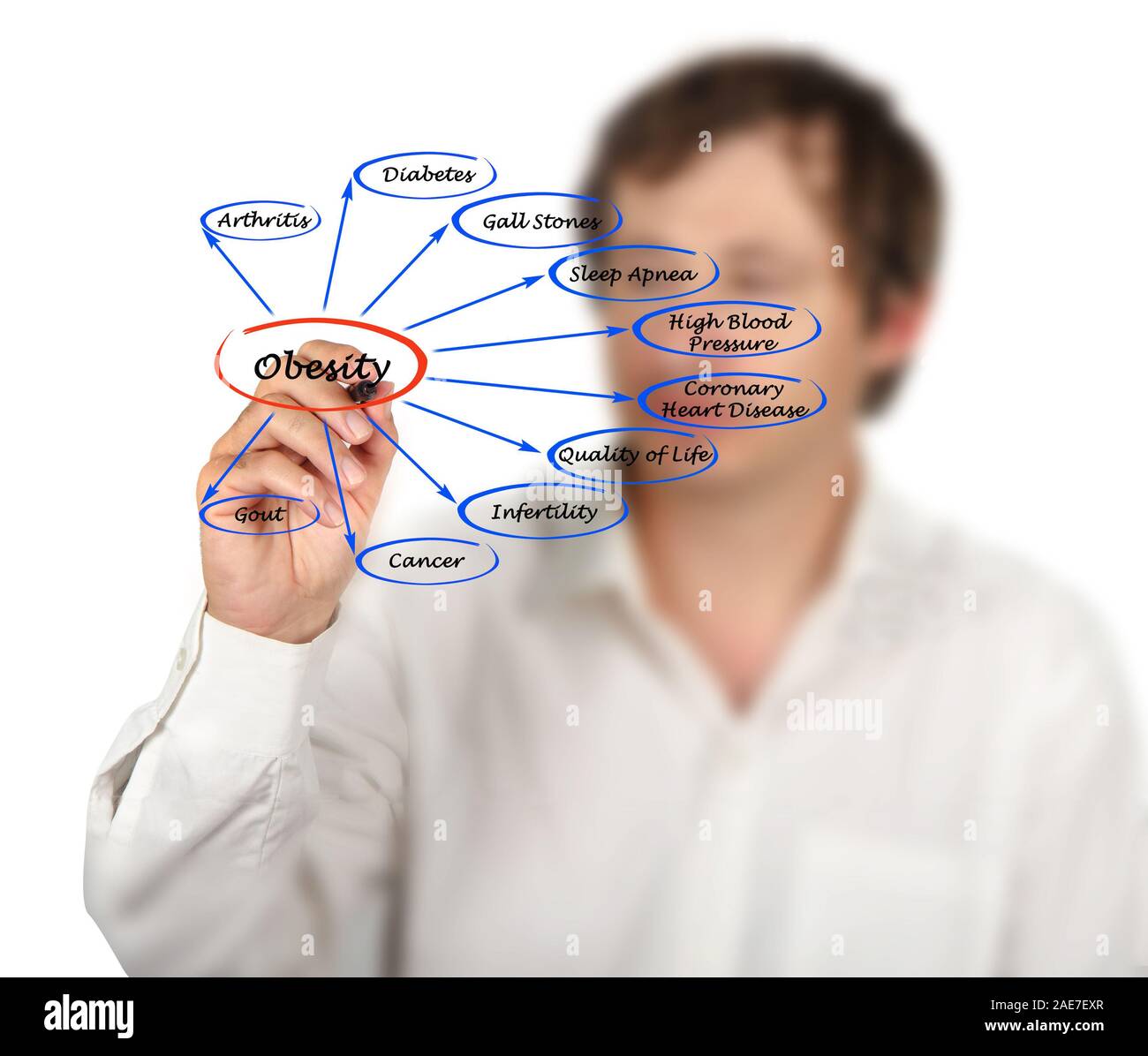 Diagram of Obesity Stock Photo - Alamy