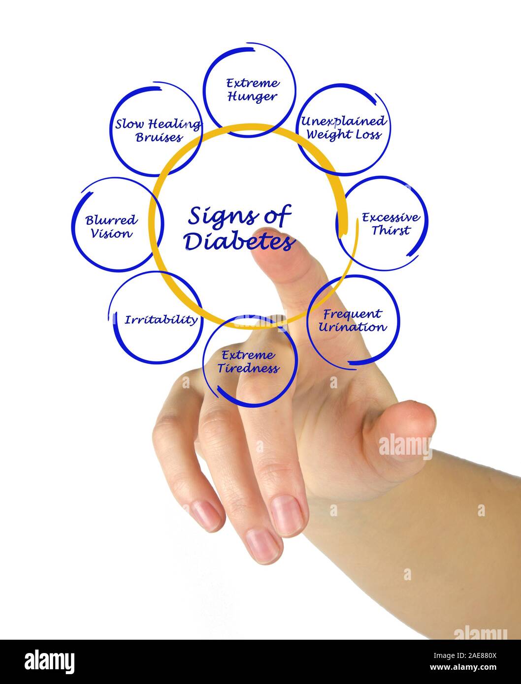 signs of diabetes Stock Photo - Alamy