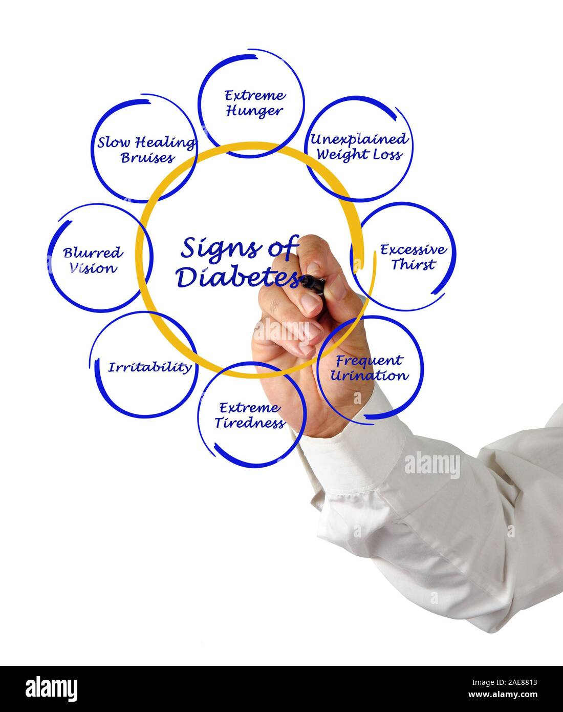Sign of diabetes Stock Photo - Alamy