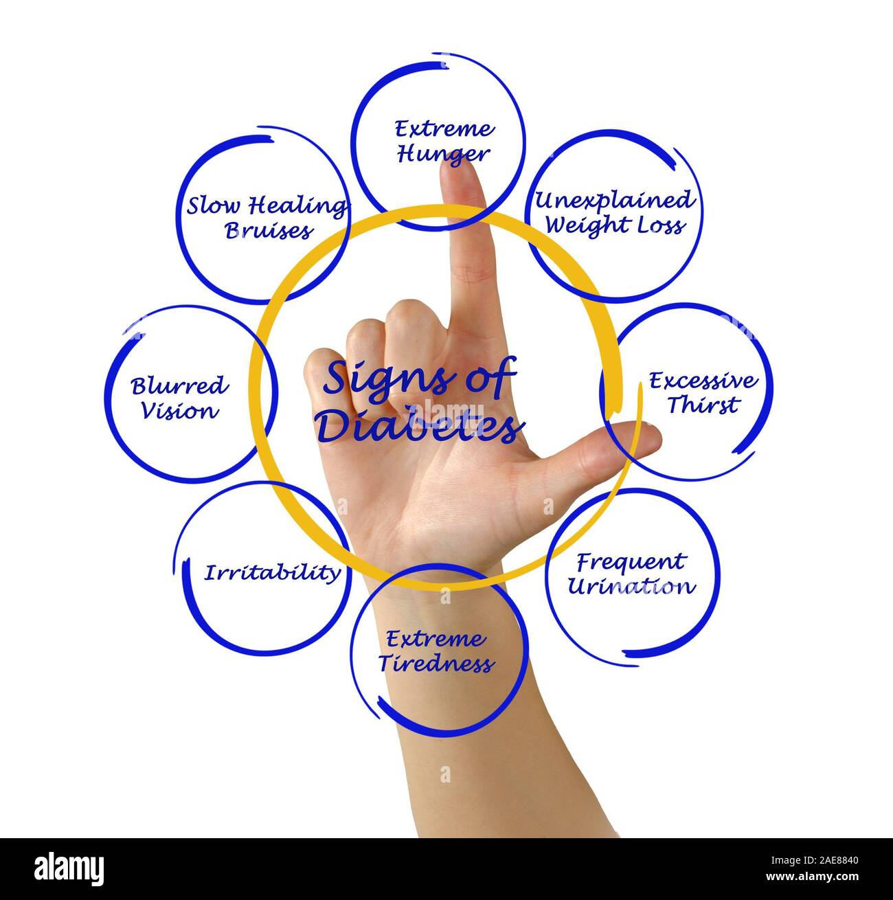 signs of diabetes Stock Photo - Alamy