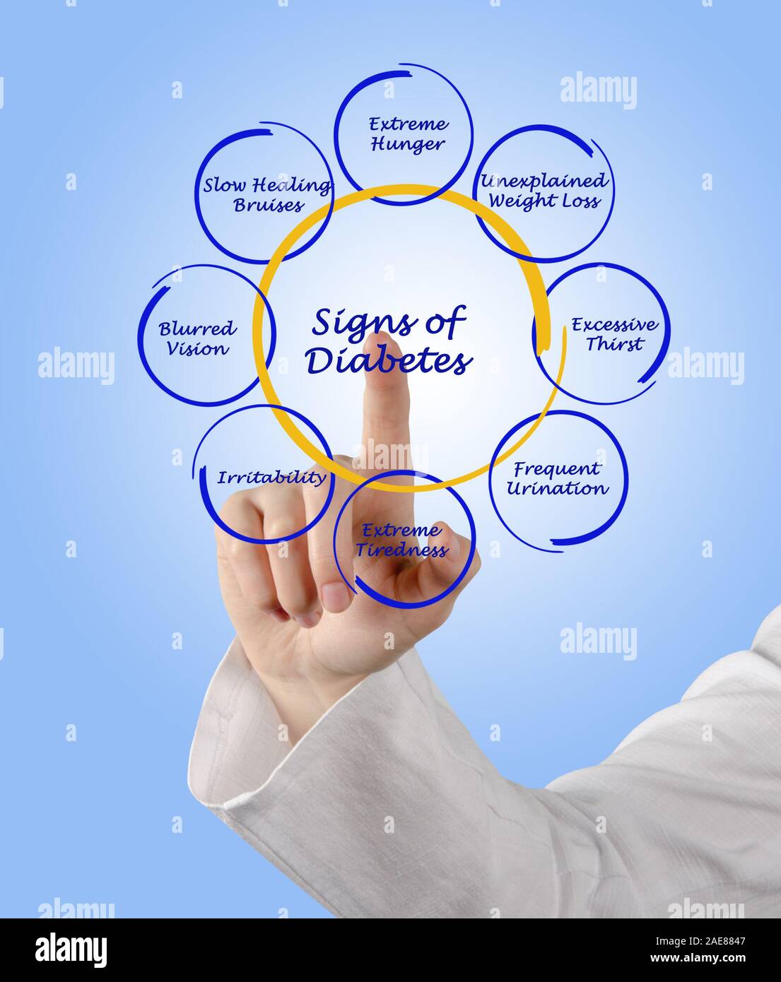 signs of diabetes Stock Photo - Alamy