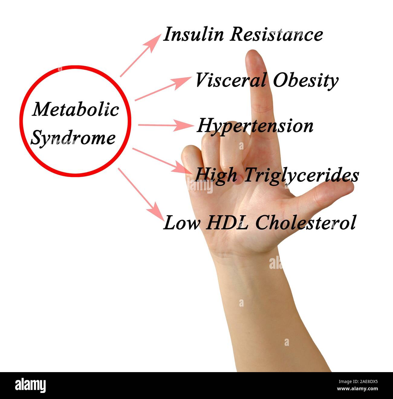 Symptoms of Metabolic Syndrome Stock Photo - Alamy