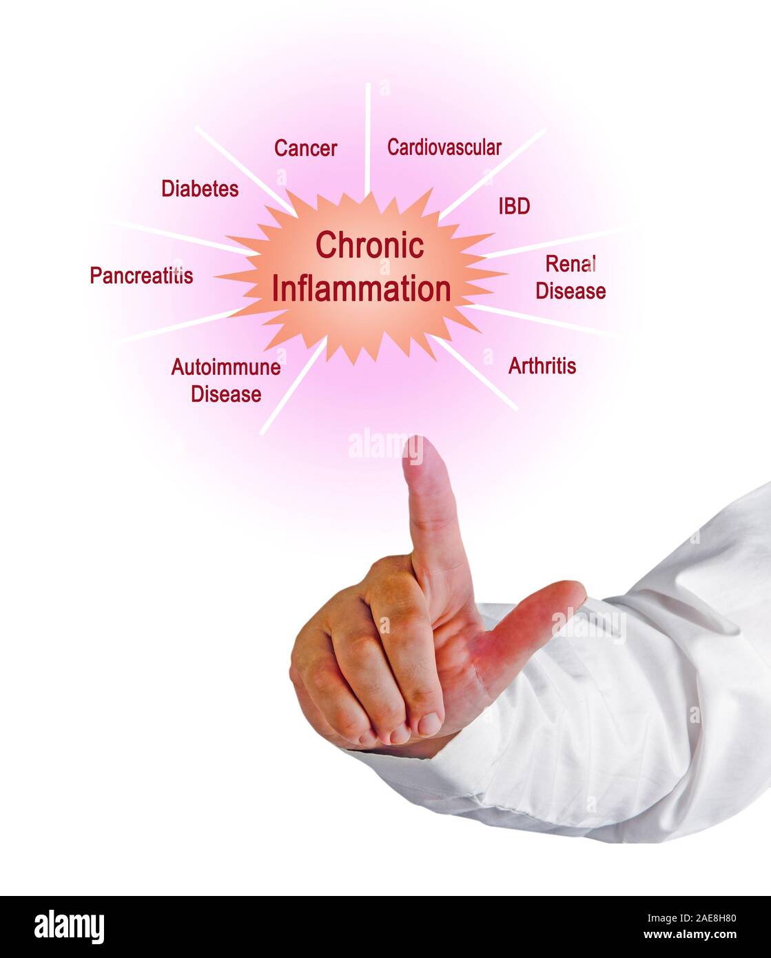 consequences of Chronic Inflammation Stock Photo - Alamy