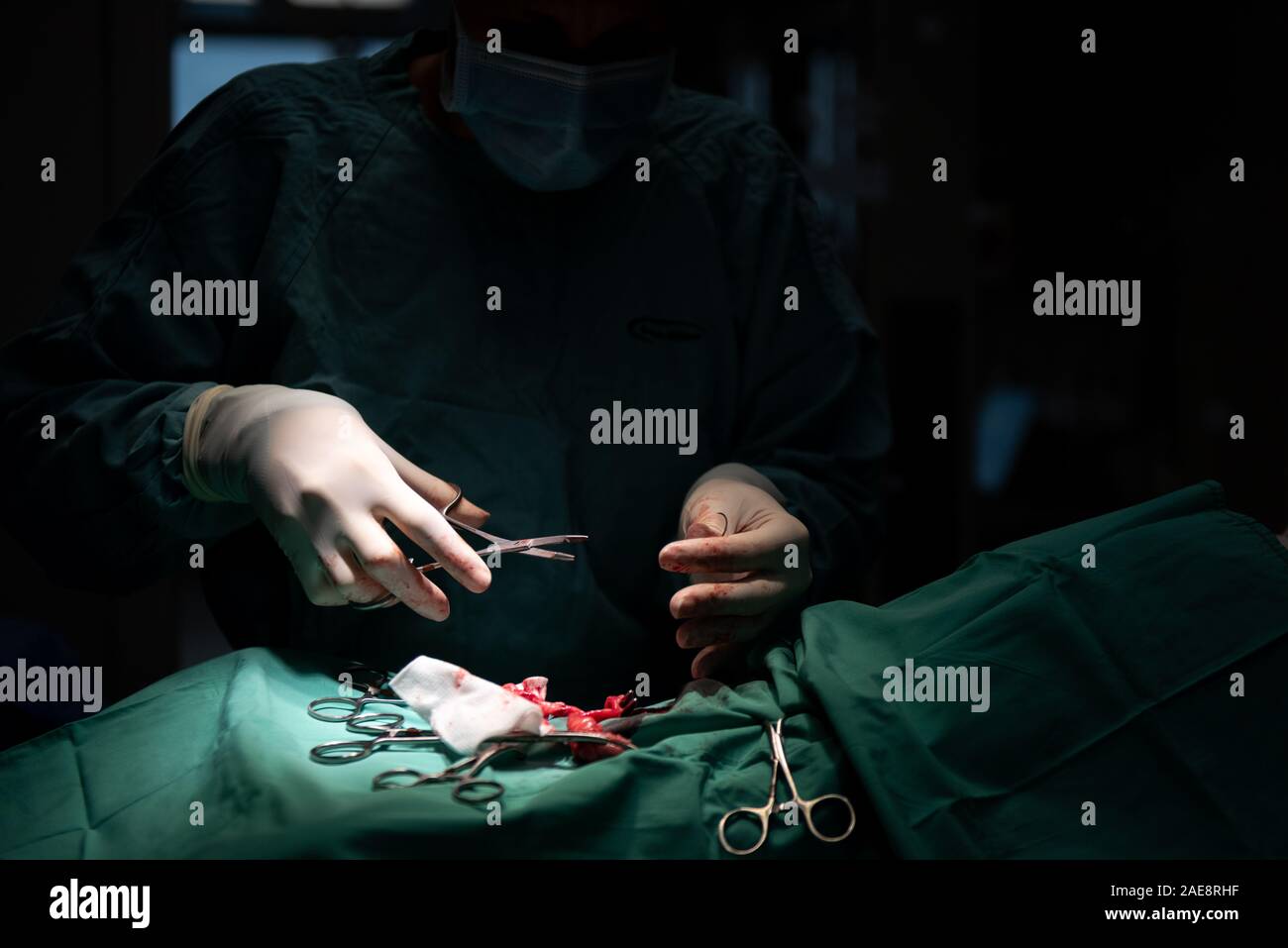 Laparotomy hi-res stock photography and images - Alamy