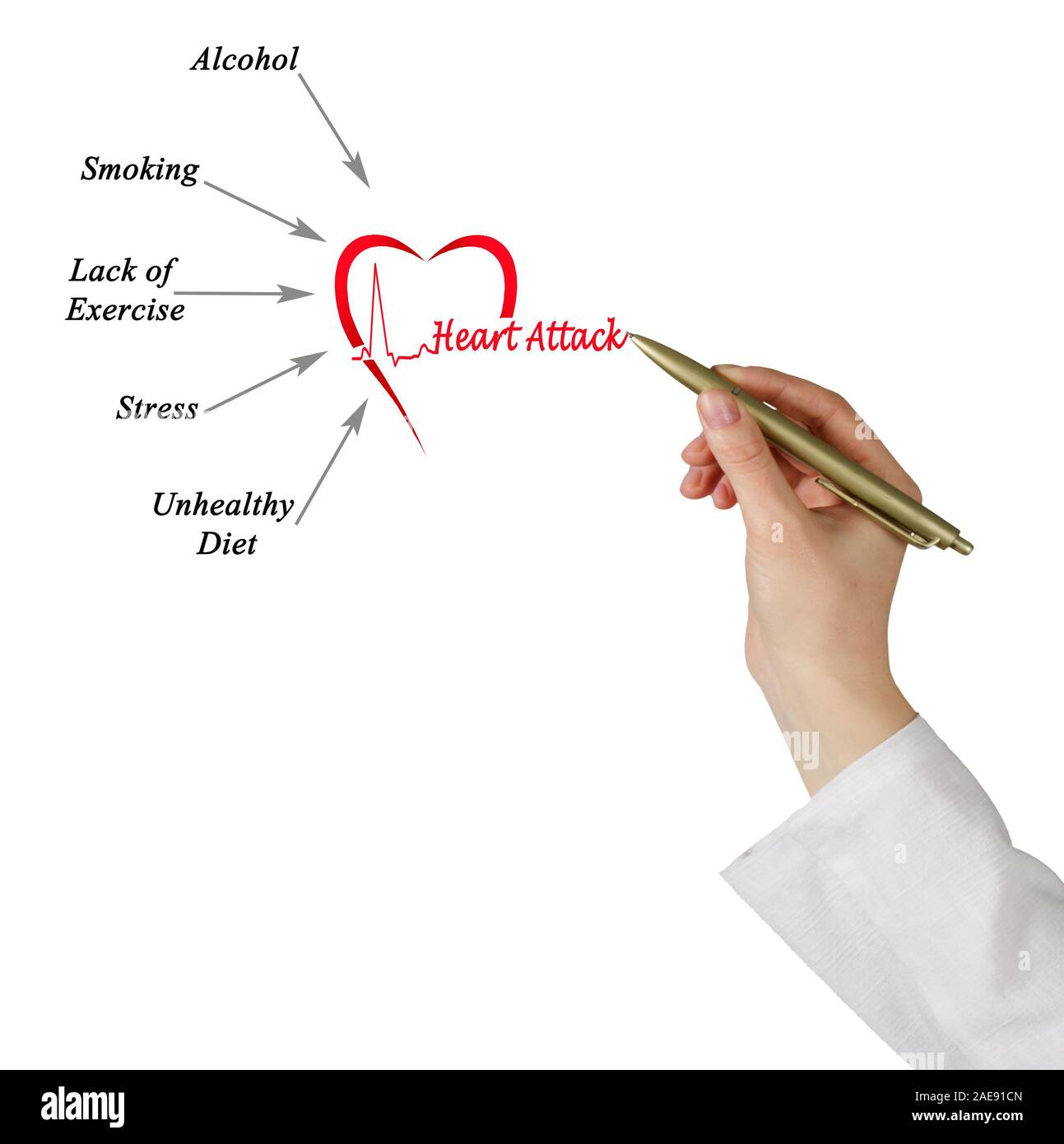 Causes of heart attack Stock Photo - Alamy