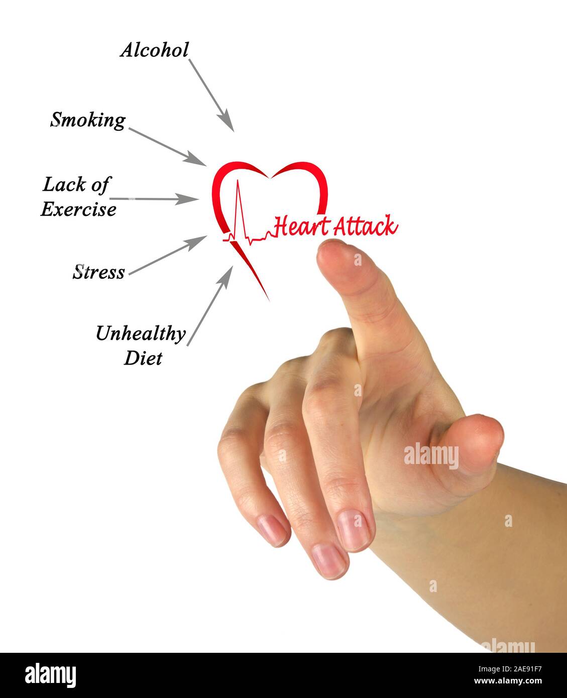 Causes of heart attack Stock Photo - Alamy