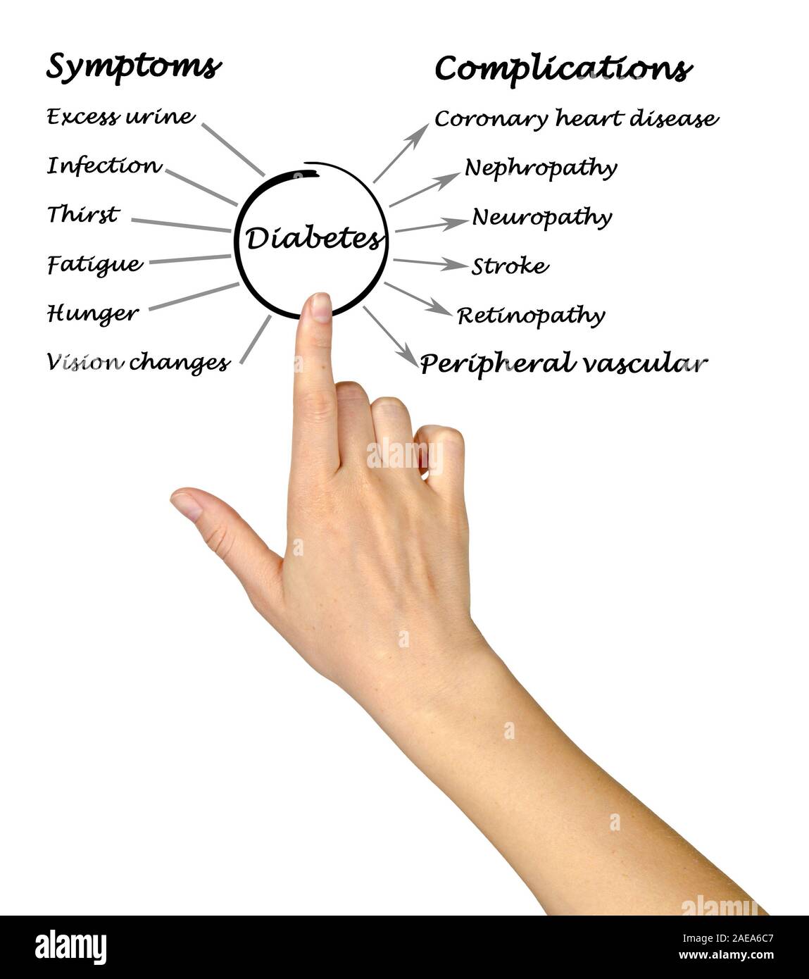 Symptoms and complications of Diabetes Stock Photo - Alamy