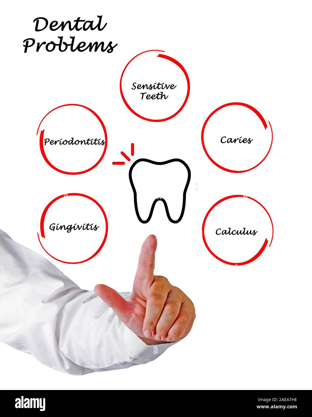 Dental caries cavities Cut Out Stock Images & Pictures - Alamy