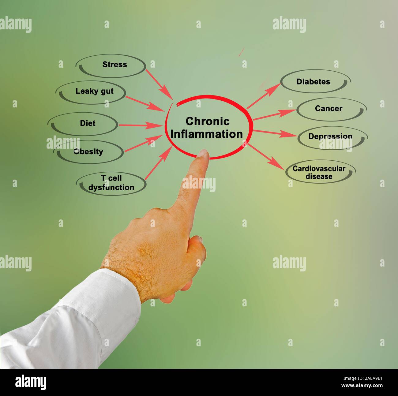 Causes and effect of Chronic Inflammation Stock Photo - Alamy