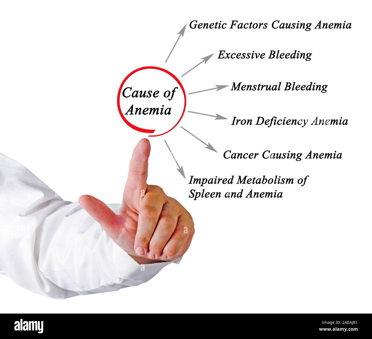 Causes of Anemia Stock Photo - Alamy