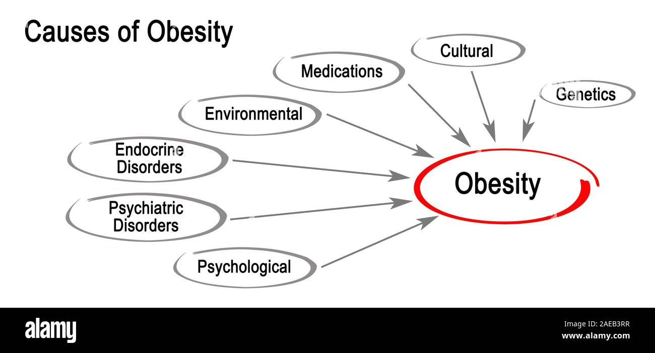 Causes of Obesity Stock Photo - Alamy