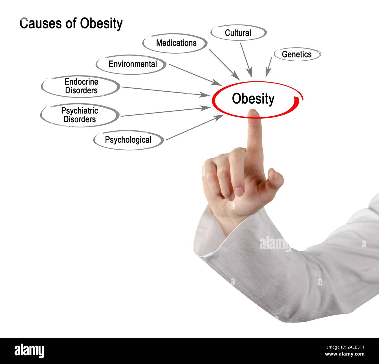 Causes of Obesity Stock Photo - Alamy