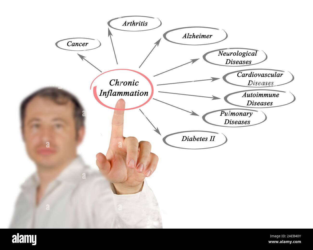 Neurological effect hi-res stock photography and images - Alamy