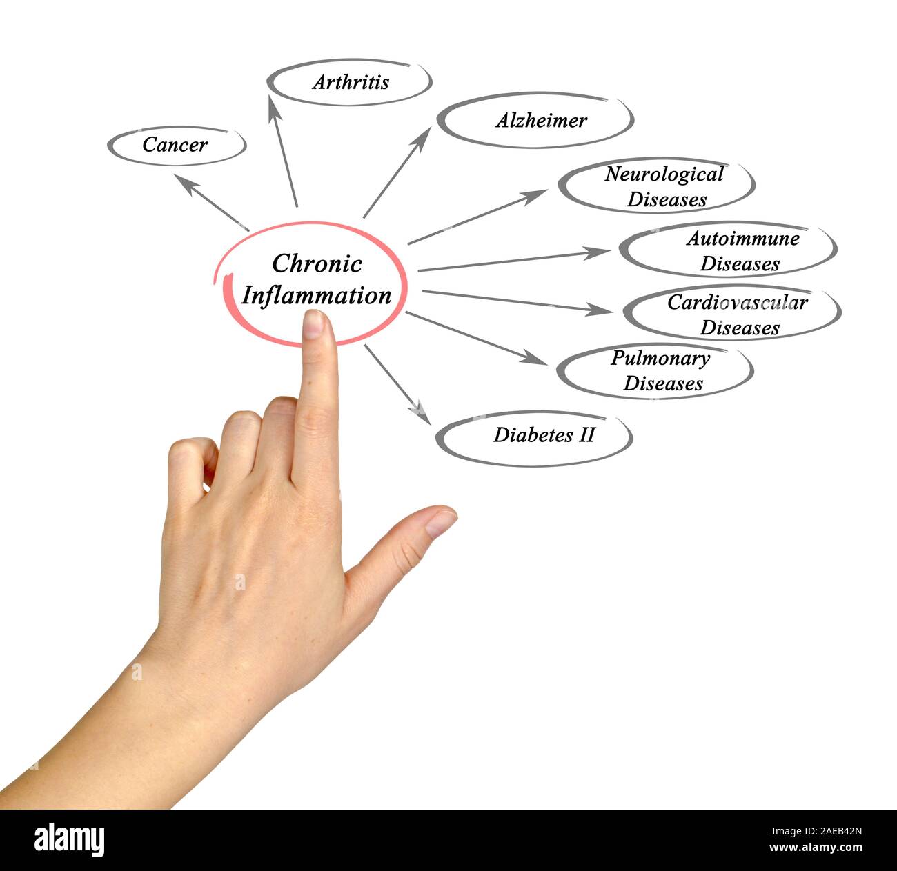 Neurological effect hi-res stock photography and images - Alamy