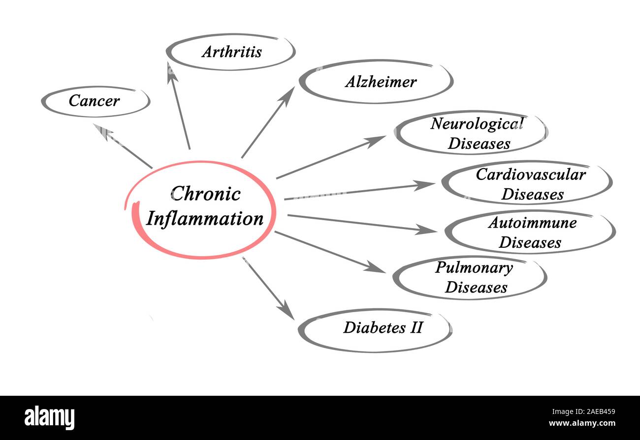 Chronic inflammation hi-res stock photography and images - Alamy