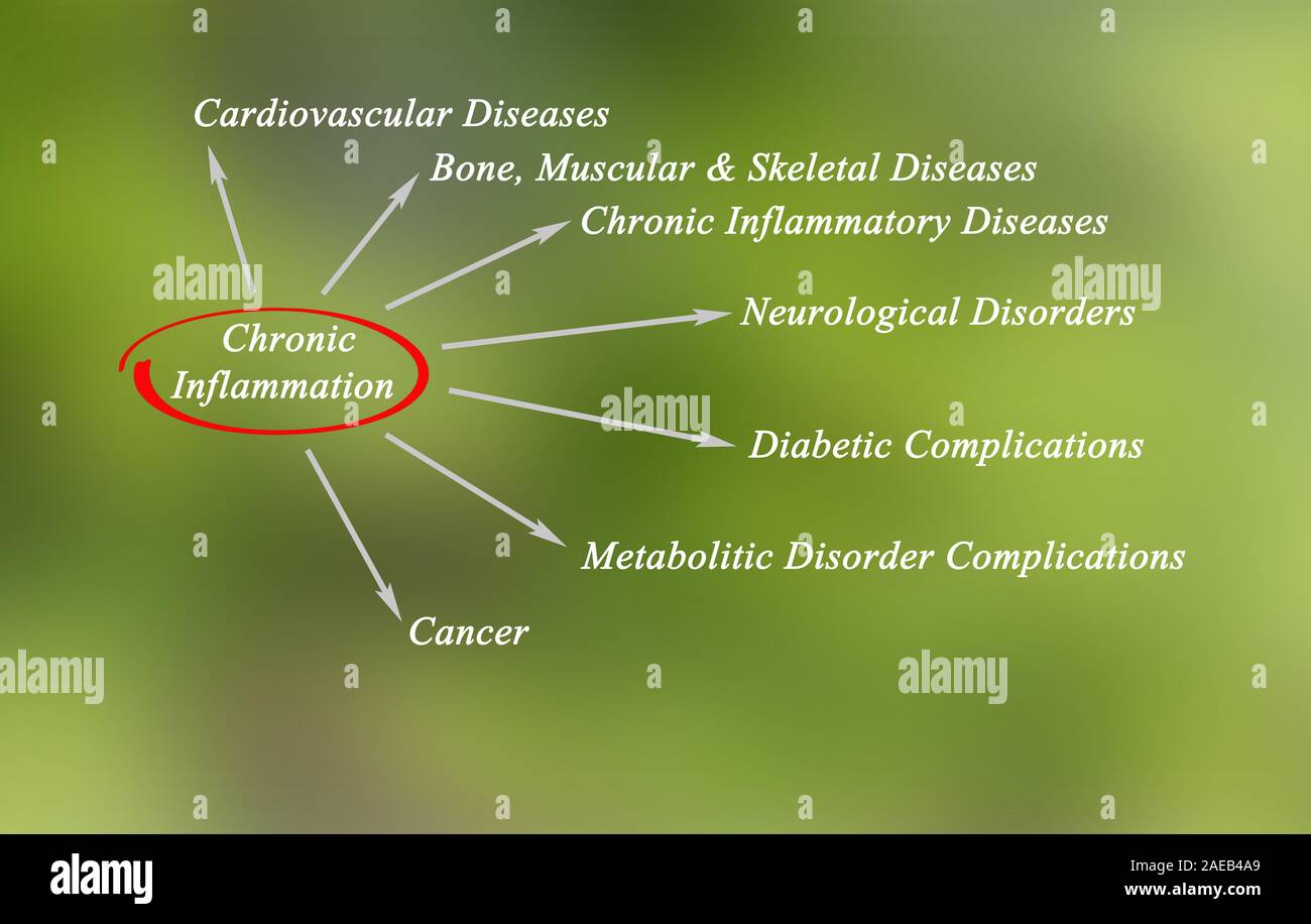 Chronic inflammation hi-res stock photography and images - Alamy
