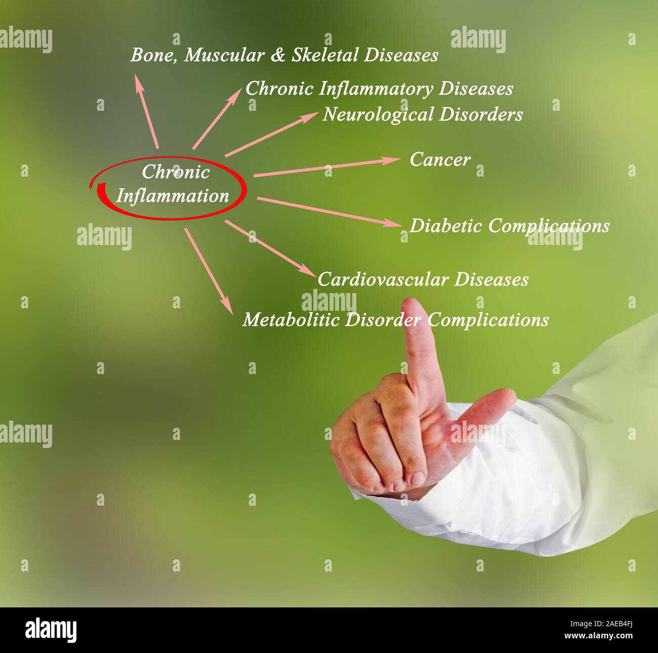Consequences of Chronic Inflammation Stock Photo - Alamy