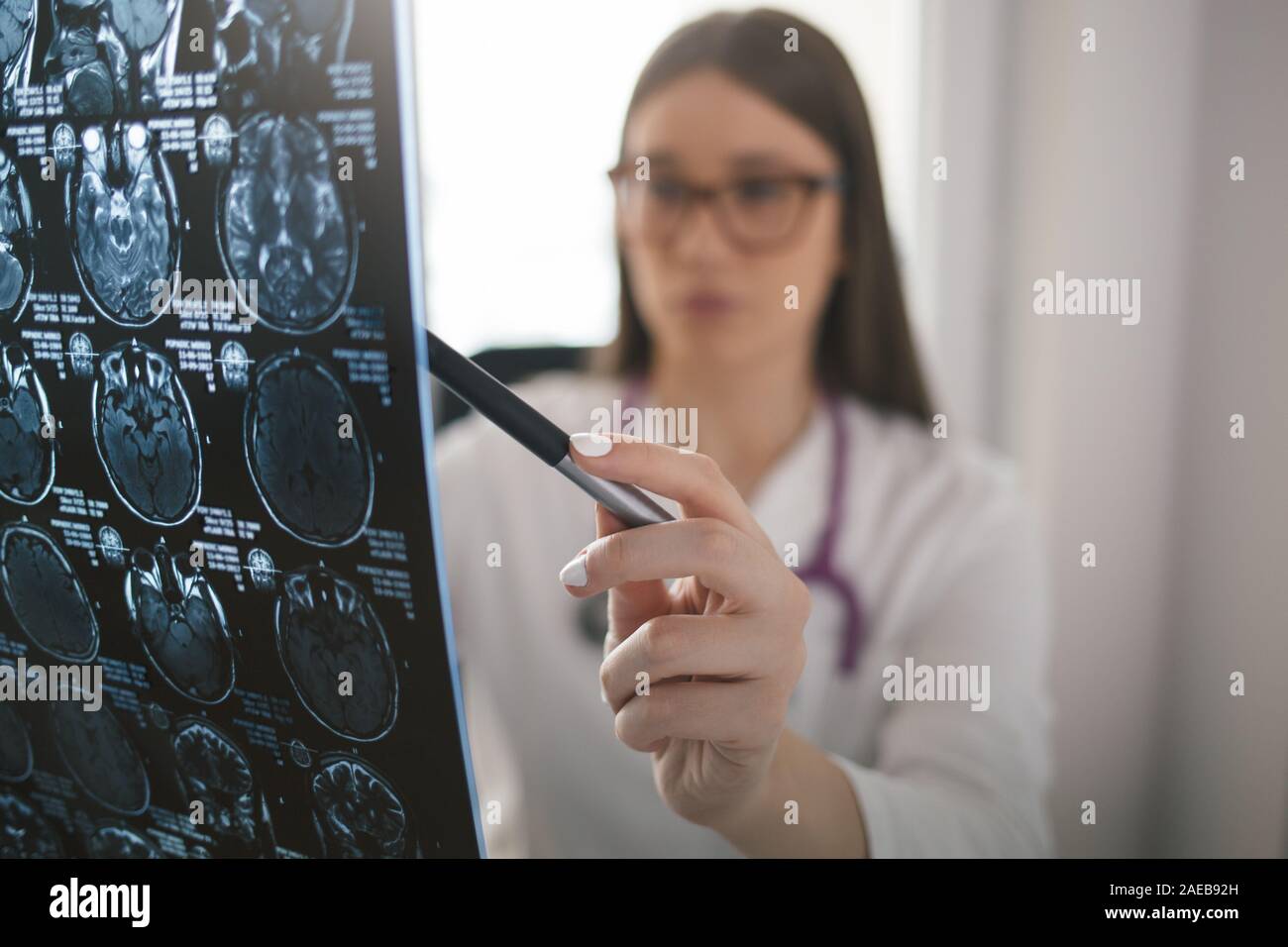 Female doctor looking at mri head scan Stock Photo - Alamy