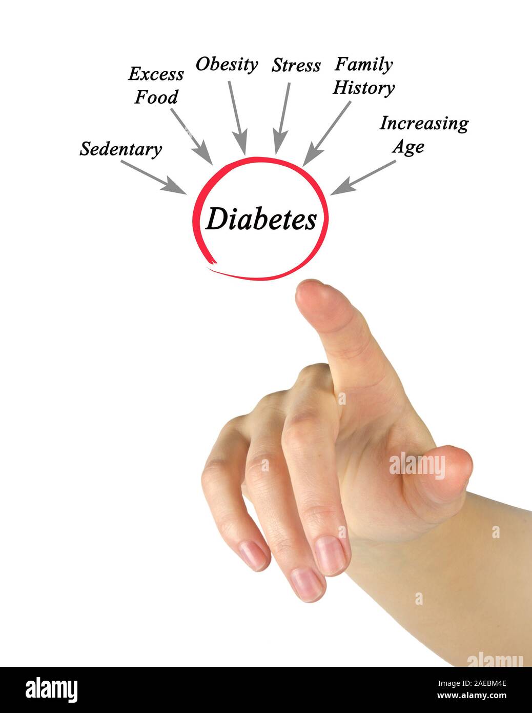 Causes of diabetes hi-res stock photography and images - Alamy