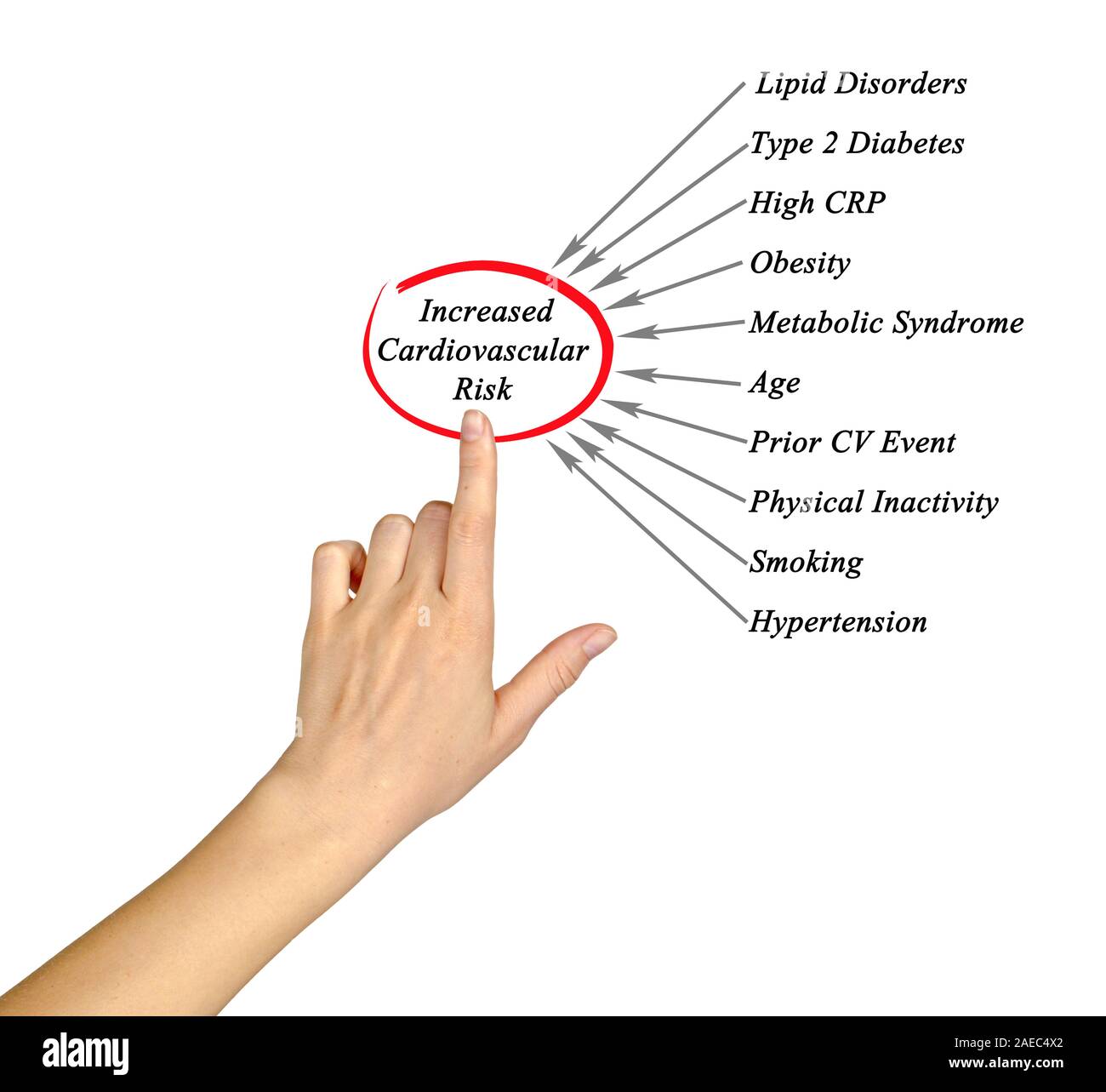 Cardiovascular risk hi-res stock photography and images - Alamy