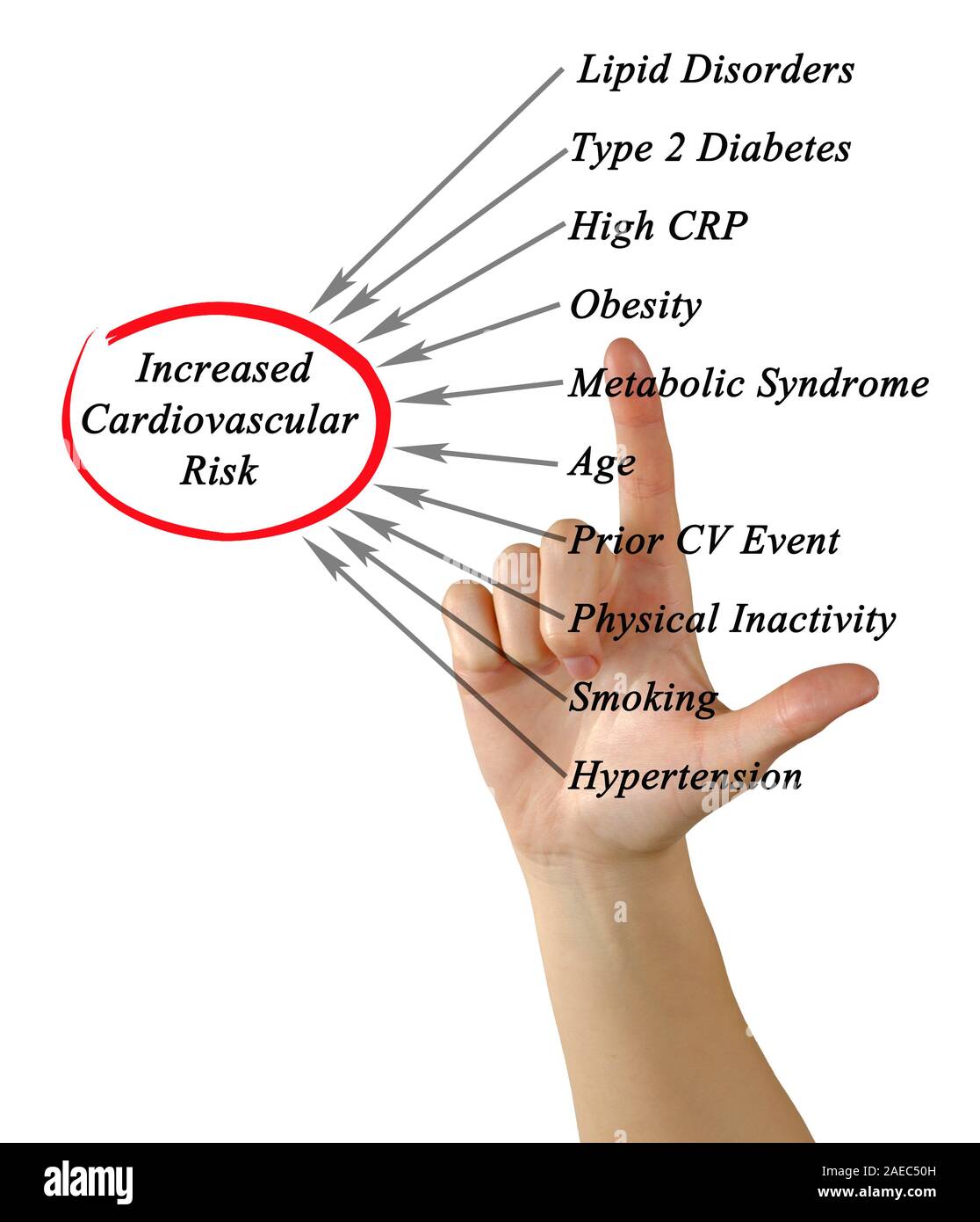 Cardiovascular disease diagram Cut Out Stock Images & Pictures - Alamy