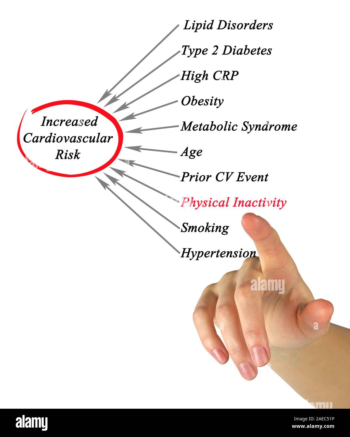Cv disease hi-res stock photography and images - Alamy