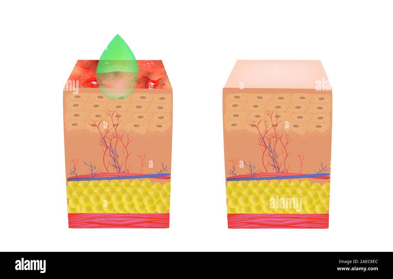 Woman face peel chemical Stock Vector Images - Alamy