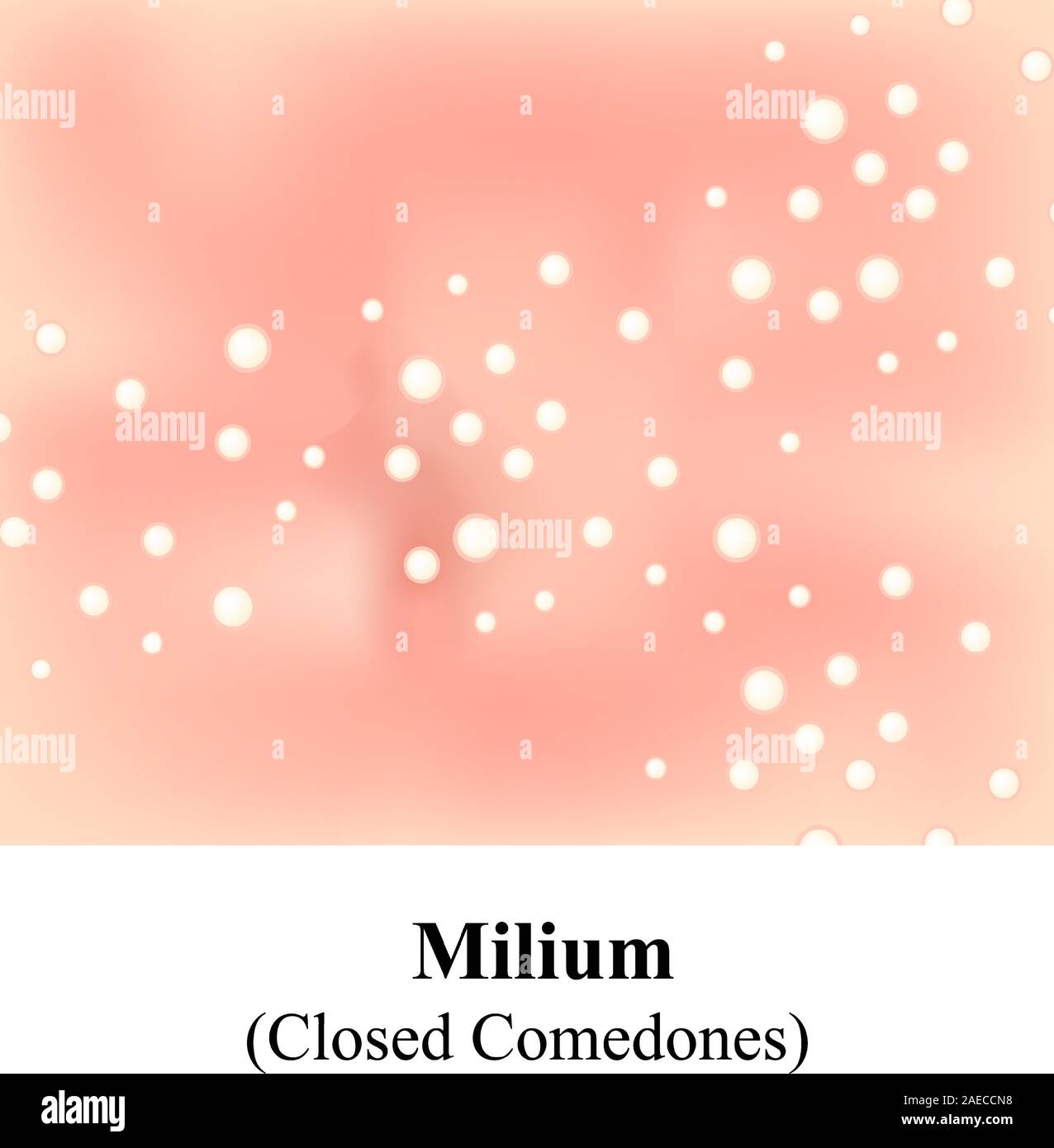 Milium Stock Vector Images - Alamy