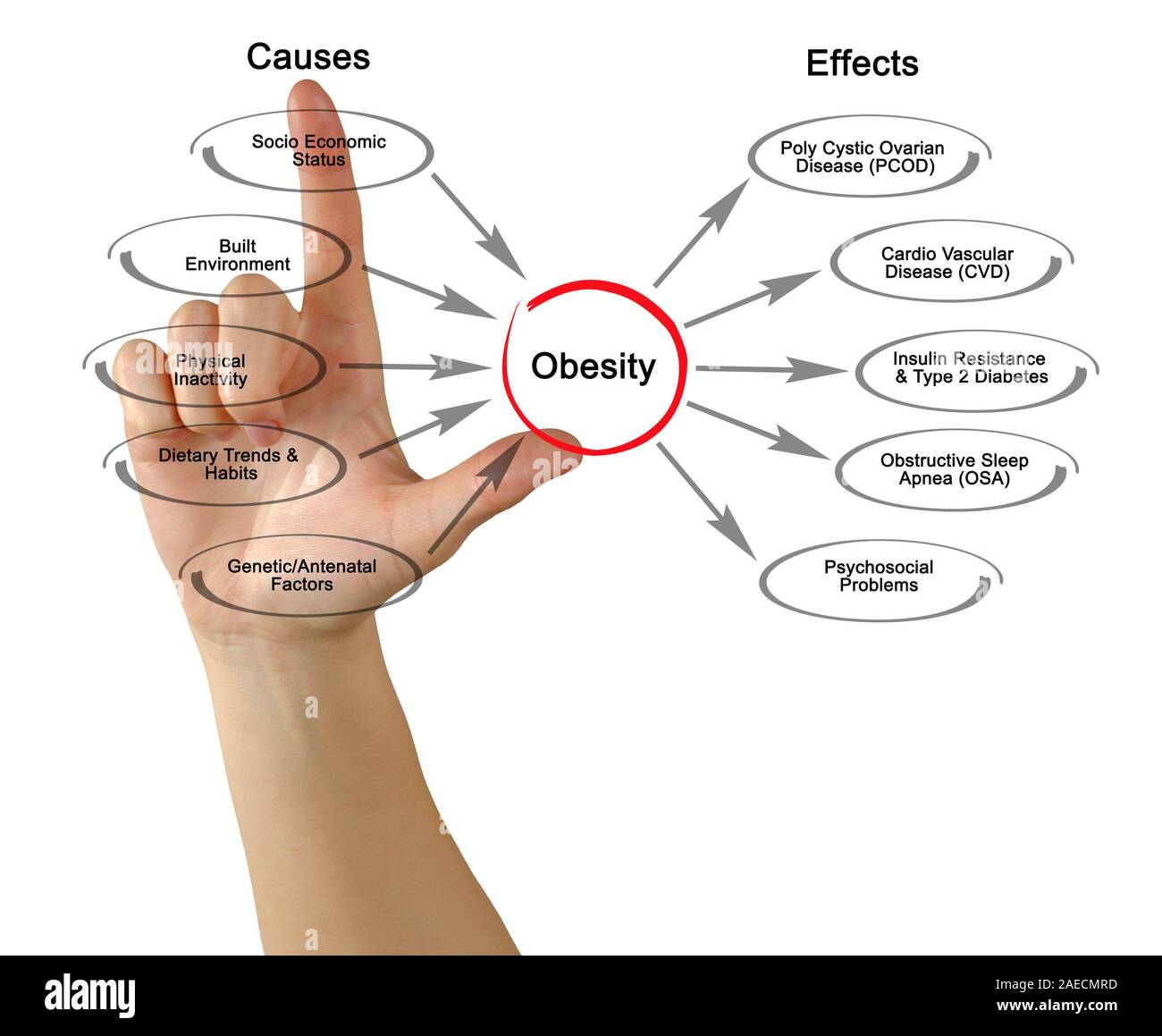 Obesity: causes and effects Stock Photo - Alamy