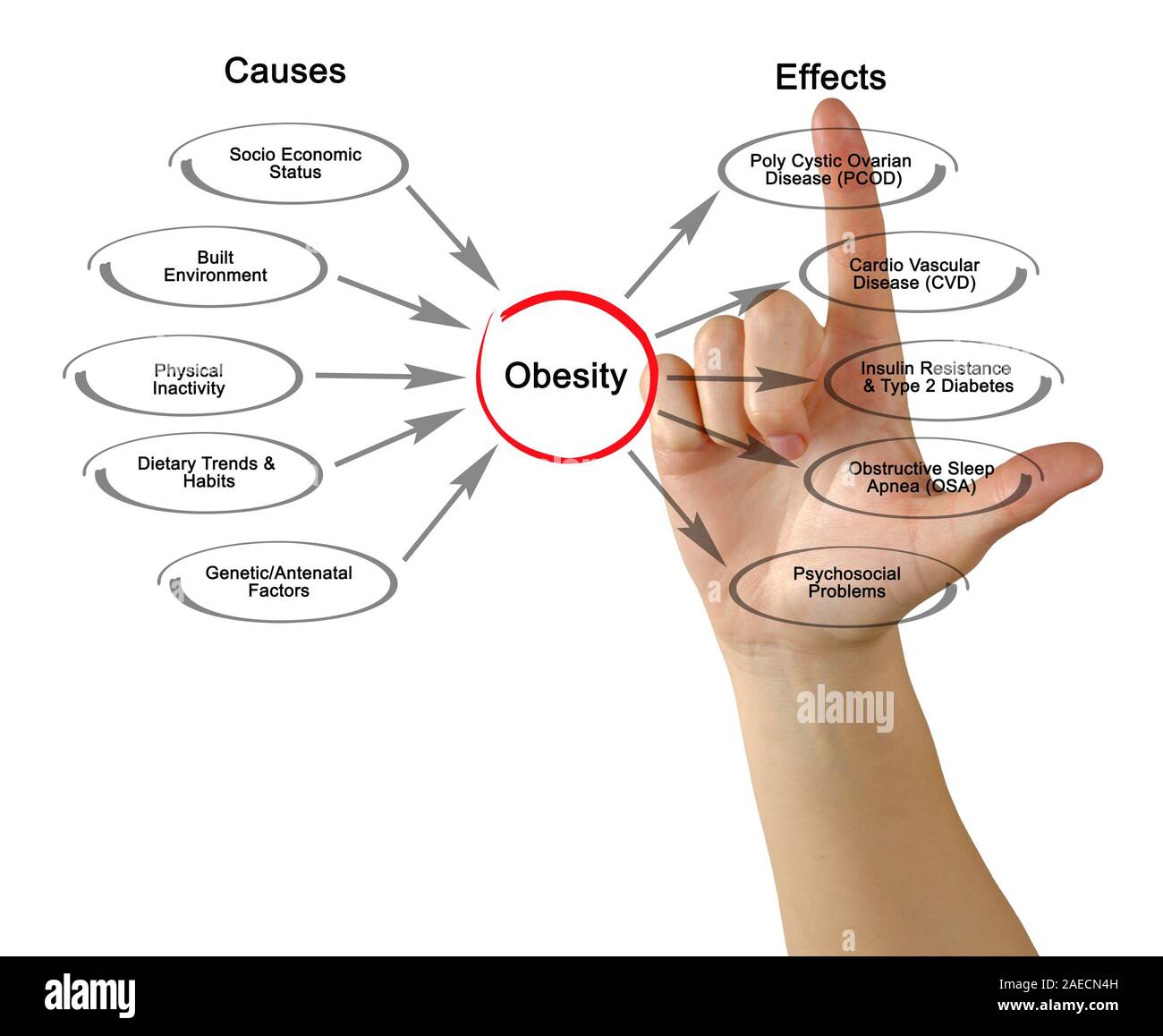 Obesity: causes and effects Stock Photo - Alamy