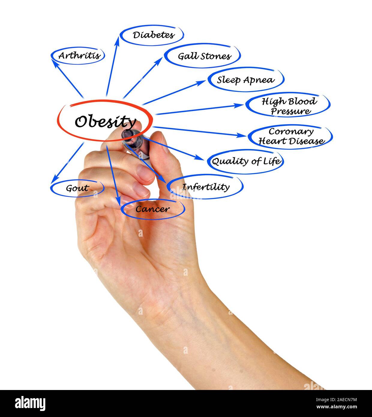 Diagram of Obesity Stock Photo - Alamy