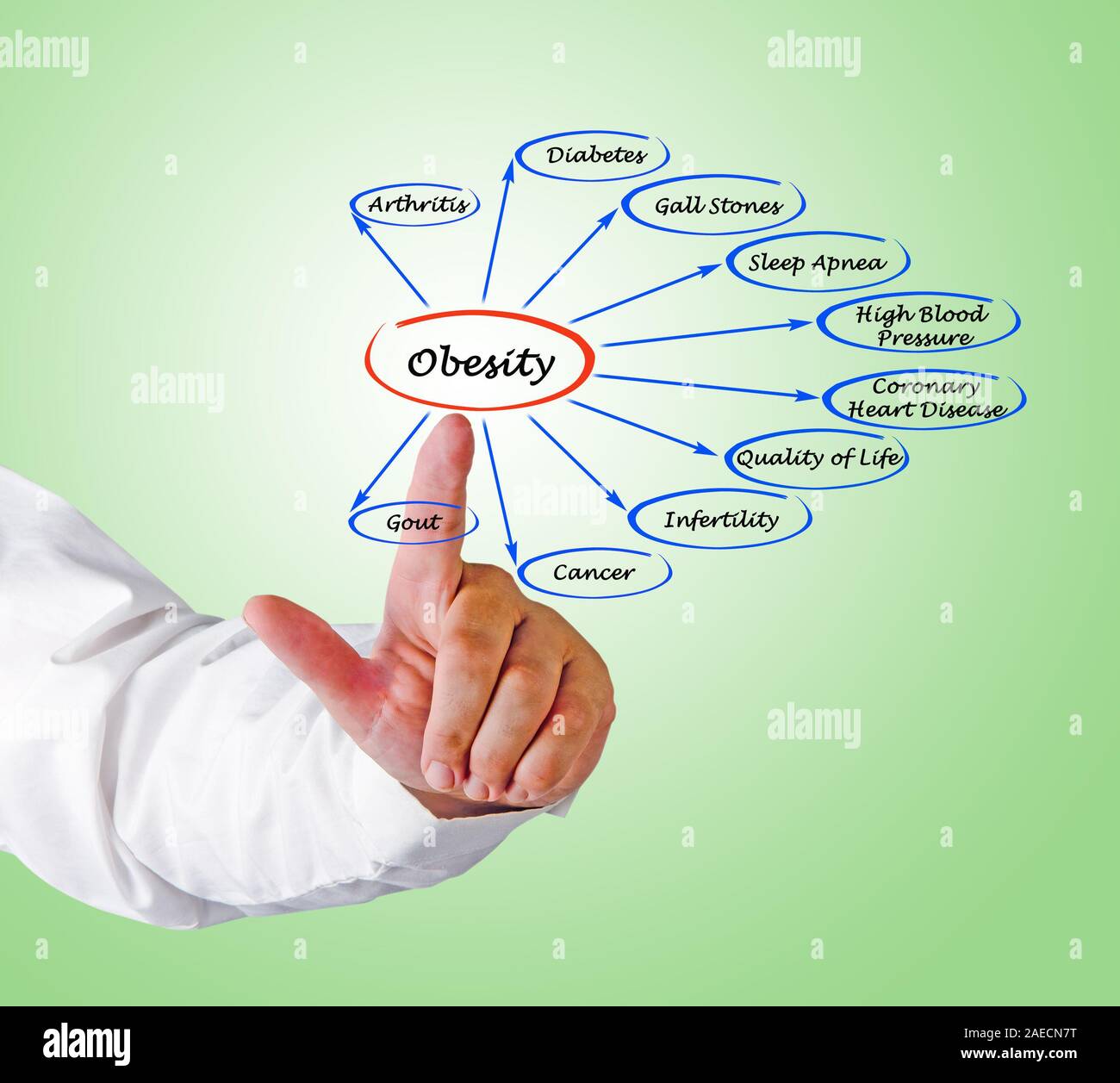Diagram of Obesity Stock Photo - Alamy