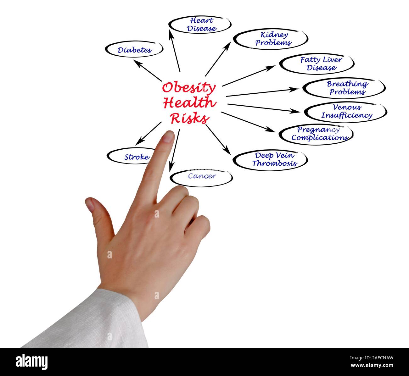 Obesity Health Risks Stock Photo - Alamy