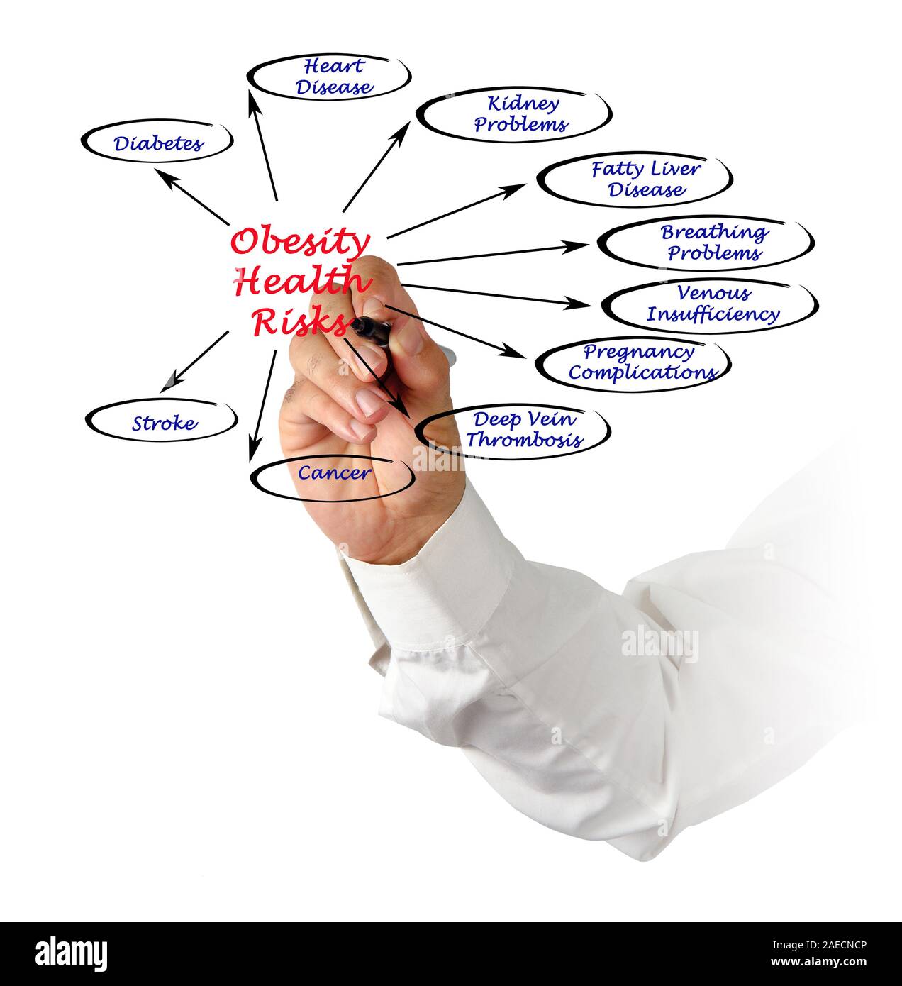 Obesity Health Risks Stock Photo - Alamy